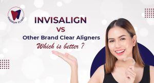 Invisalign vs Other Brand Clear Aligners: Which is Better?