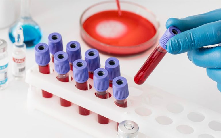 Blood Test Packages in Dubai | Full Body Checkup Packages - Magnum Clinic