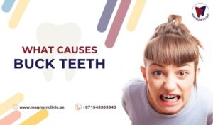 What Causes Buck Teeth? Buck Teeth Treatment | Magnum Clinic