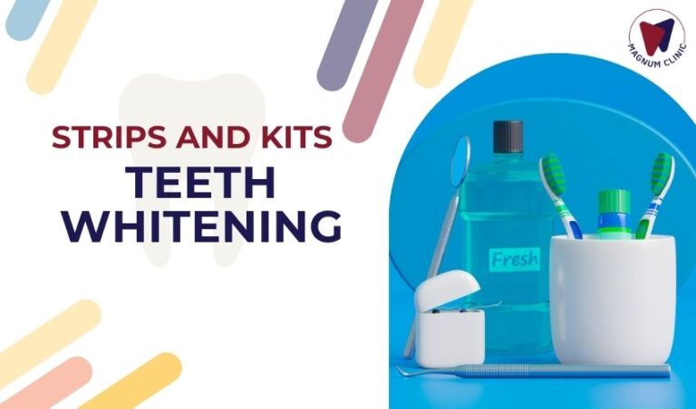 The Best Teeth Whitening Strips And Kits | Magnum Clinic