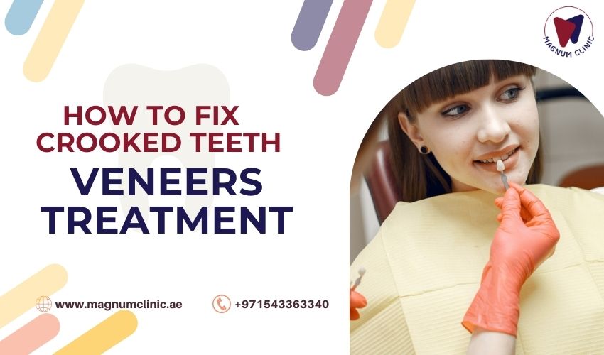 Can Veneers Fix Crooked Teeth? | Magnum Clinic Can Veneers Fix Crooked Teeth? | Magnum Clinic