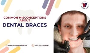 Common Misconceptions About Dental Braces Debunked