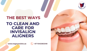 The Best Ways to Clean and Care for Invisalign Aligners - Magnum Clinic