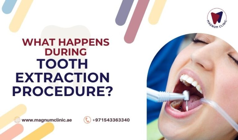 What Happens During a Tooth Extraction Procedure? | Magnum Clinic