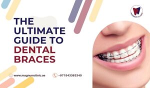 The Ultimate Guide to Dental Braces