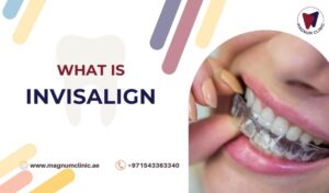 What Is Invisalign and How Does It Work?